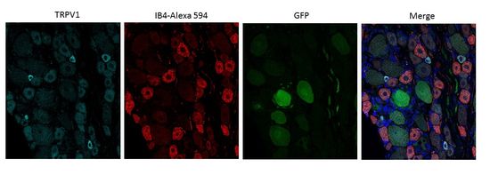 VR1/ TRPV1抗体 (GTX10296) | GeneTex中国官方网站