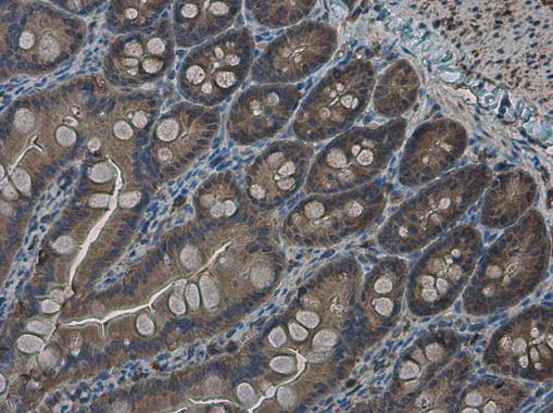 RRM2抗体 [N1C1] (GTX103193) | GeneTex中国官方网站