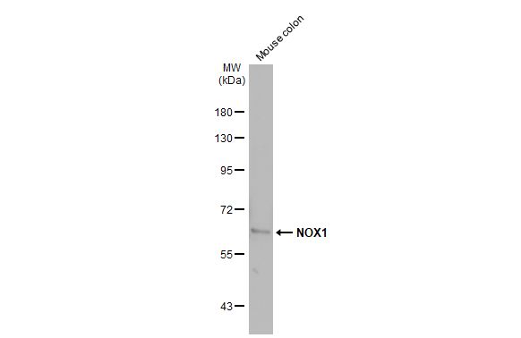 NOX1抗体 (GTX103888) | GeneTex中国官方网站