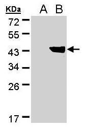 DHDH antibody [N1C3]价格,详情介绍-960化工网 – 960化工网