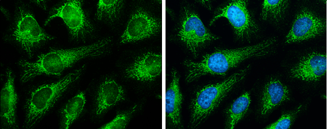 Grp75抗体 (GTX104407) | GeneTex中国官方网站