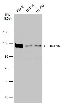 USP15抗体 [C3], C-term (GTX104644) | GeneTex中国官方网站