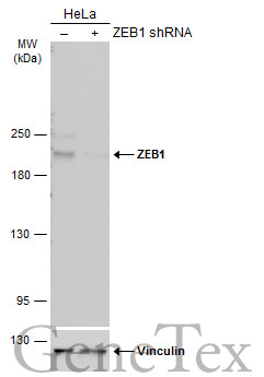 ZEB1抗体 [N2C1], Internal (GTX105278) | GeneTex中国官方网站