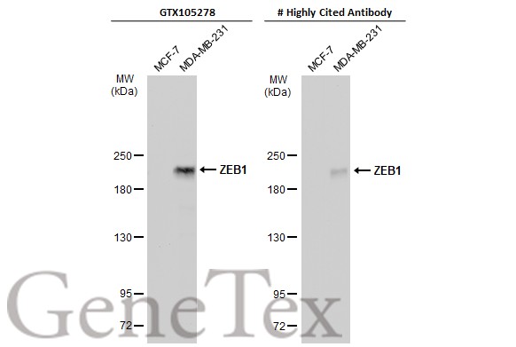 ZEB1抗体 [N2C1], Internal (GTX105278) | GeneTex中国官方网站
