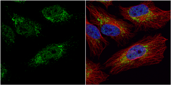 PGK1抗体 (GTX107614) | GeneTex中国官方网站