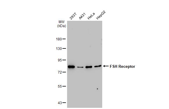 FSH Receptor抗体 [C3], C-term (GTX108202) | GeneTex中国官方网站