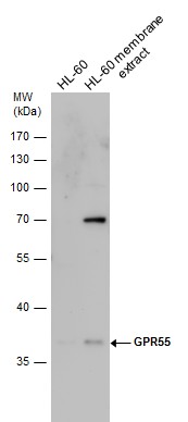 GPR55抗体 (GTX108243) | GeneTex中国官方网站