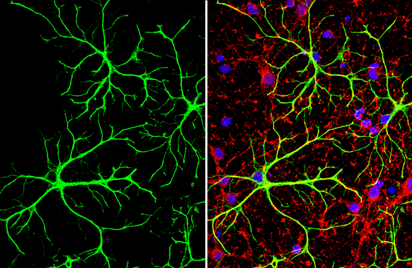 GFAP抗体 (GTX108711) | GeneTex中国官方网站