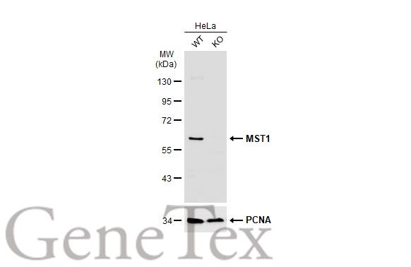MST1抗体 (GTX109294) | GeneTex中国官方网站