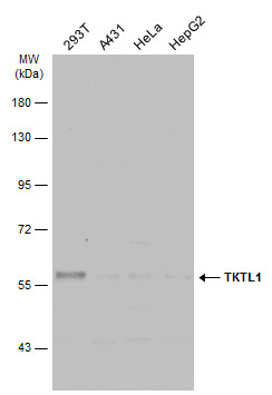 TKTL1抗体 [N1C1] (GTX109459) | GeneTex中国官方网站