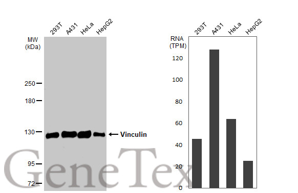 Vinculin抗体 [N3C1], Internal (GTX109749) | GeneTex中国官方网站