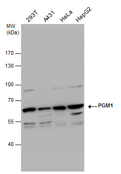PGM1抗体 (GTX110069) | GeneTex中国官方网站