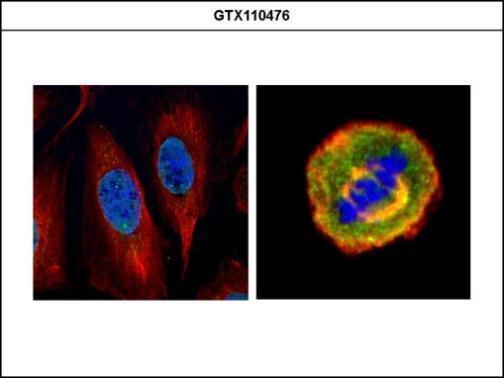 SUMO1抗体 (GTX110476) | GeneTex中国官方网站