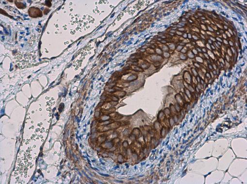 TNF alpha抗体 (GTX110520) | GeneTex中国官方网站