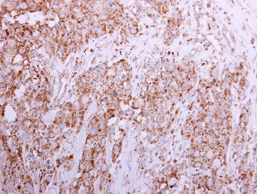 Sortilin 1抗体 [C1C3] (GTX110857) | GeneTex中国官方网站