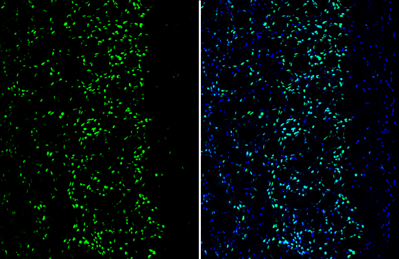 MEF2C抗体 (GTX111134) | GeneTex中国官方网站