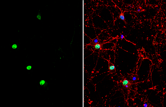 MEF2C抗体 (GTX111134) | GeneTex中国官方网站
