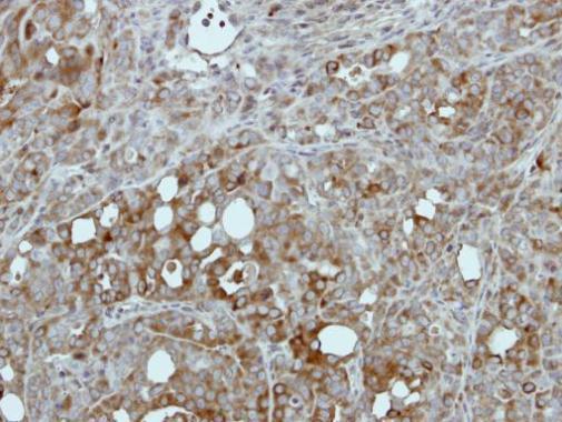 Pyruvate Kinase (liver/RBC)抗体 (GTX111536) | GeneTex中国官方网站