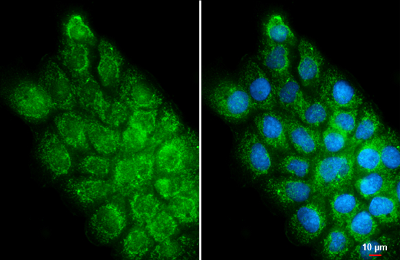 mAChR M3抗体 (GTX111637) | GeneTex中国官方网站