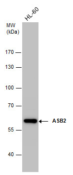 ASB2 antibody [N3C2], Internal价格,详情介绍-960化工网 – 960化工网