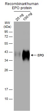 EPO抗体 (GTX112833) | GeneTex中国官方网站
