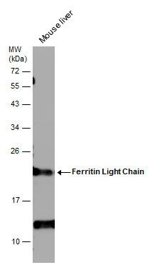 Ferritin Light Chain抗体 [N1C3-3] (GTX112943) | GeneTex中国官方网站