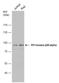 PI3 kinase p85 alpha抗体 (GTX112994) | GeneTex中国官方网站