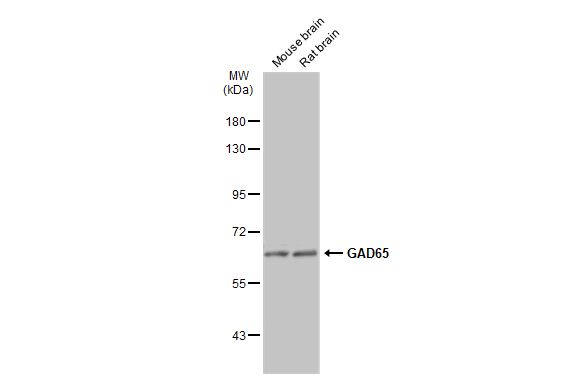 GAD65抗体 (GTX113192) | GeneTex中国官方网站