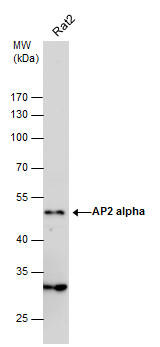 AP2 alpha antibody价格,详情介绍-960化工网 – 960化工网