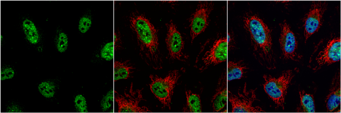 Jab1抗体 [N1C1] (GTX113927) | GeneTex中国官方网站