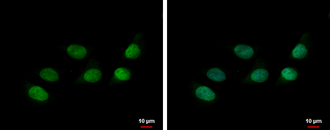 HP1 alpha抗体 (GTX113944) | GeneTex中国官方网站