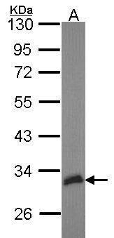 HEYL antibody [N1C1]价格,详情介绍-960化工网 – 960化工网