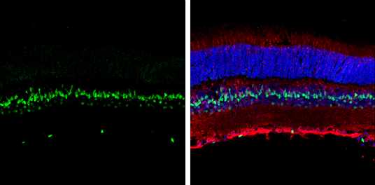 NFIA抗体 (GTX114580) | GeneTex中国官方网站