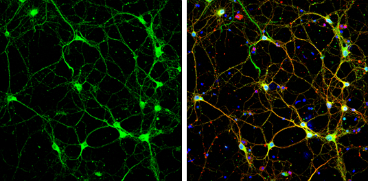 Syntaxin 4抗体 [N2C3] (GTX114806) | GeneTex中国官方网站