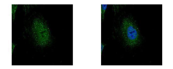 EDC4抗体 (GTX115745) | GeneTex中国官方网站