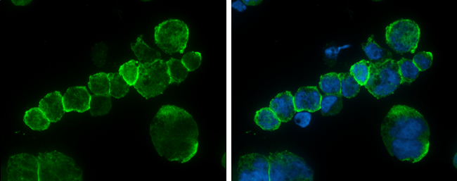CD45抗体 (GTX116018) | GeneTex中国官方网站