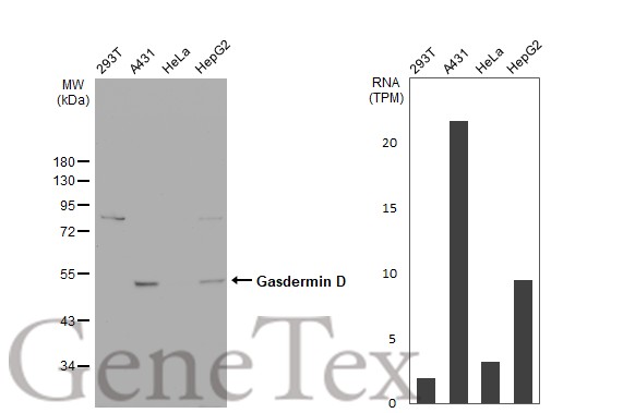 Gasdermin D抗体 [N1N3] (GTX116840) | GeneTex中国官方网站