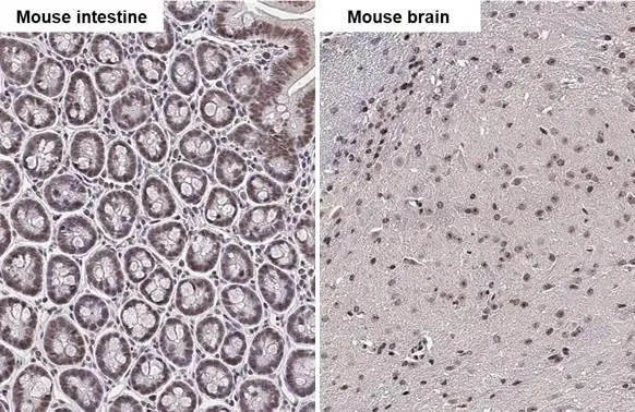 NR1H4抗体 (GTX117553) | GeneTex中国官方网站