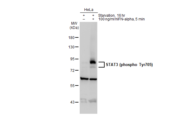STAT3 (phospho Tyr705)抗体 (GTX118000) | GeneTex中国官方网站