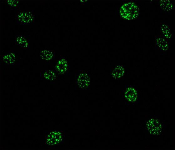 SC35抗体 [SC-35] (GTX11826) | GeneTex中国官方网站