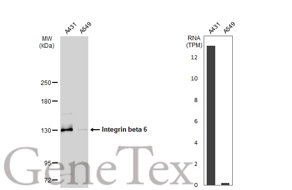 Integrin beta 6抗体 (GTX118323) | GeneTex中国官方网站