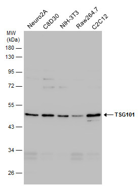 TSG101抗体 (GTX118736) | GeneTex中国官方网站