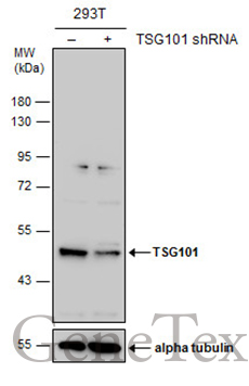 TSG101抗体 (GTX118736) | GeneTex中国官方网站