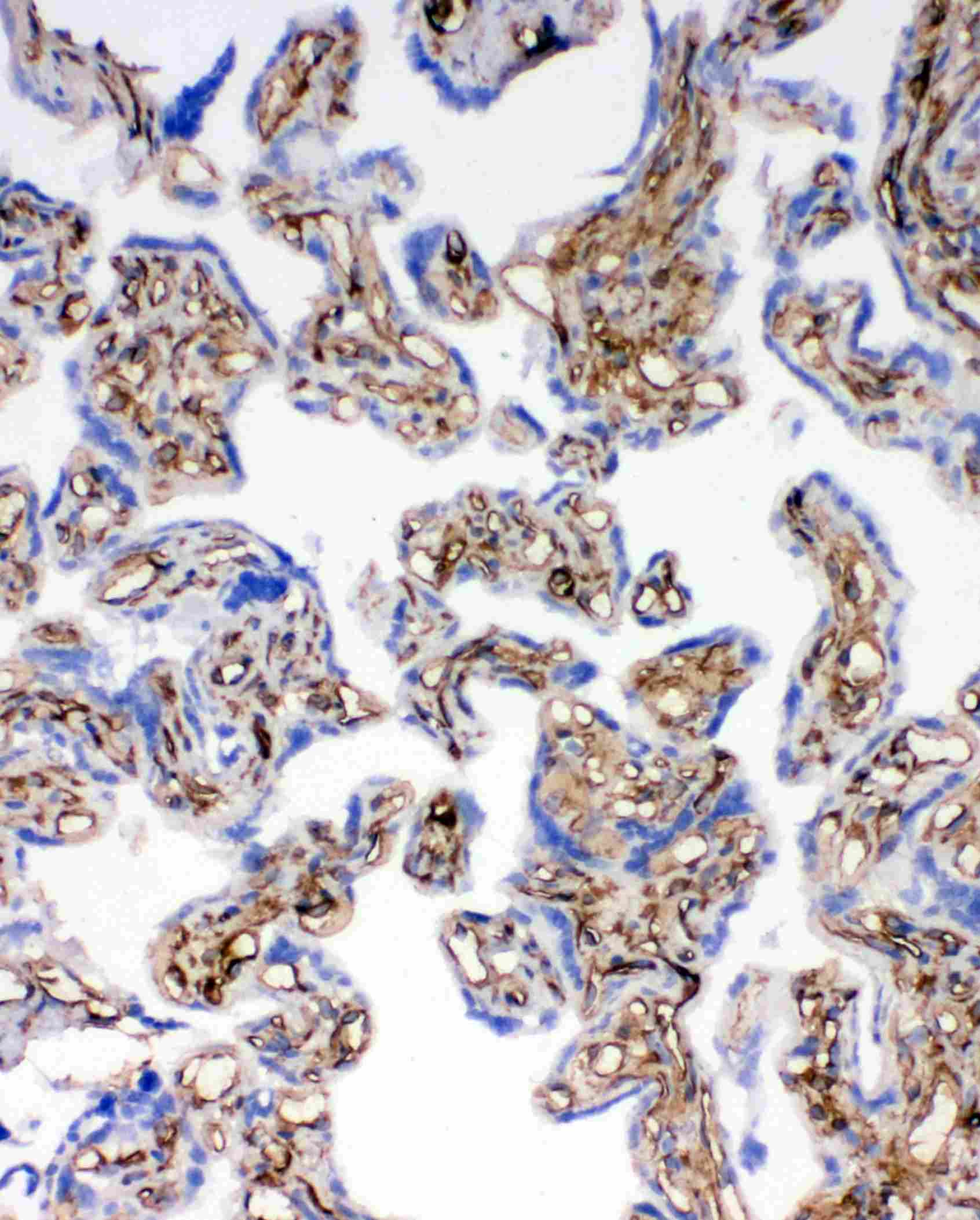 SDC2抗体 (GTX12157) | GeneTex中国官方网站