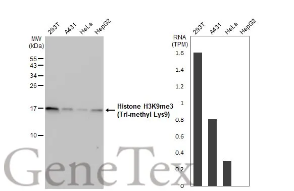 Histone H3K9me3 (Tri-methyl Lys9)抗体 (GTX121677) | GeneTex中文官方网站