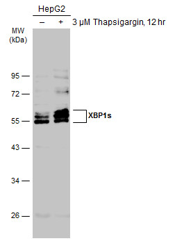 XBP1(S)抗体 (GTX122156) | GeneTex中国官方网站