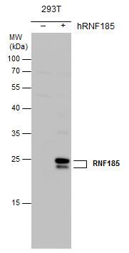 RNF185抗体 [N1C3] (GTX122691) | GeneTex中国官方网站