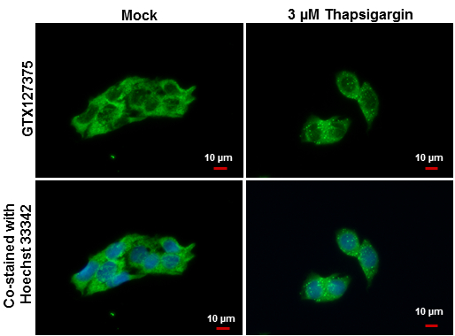 LC3B抗体 (GTX127375) | GeneTex中国官方网站
