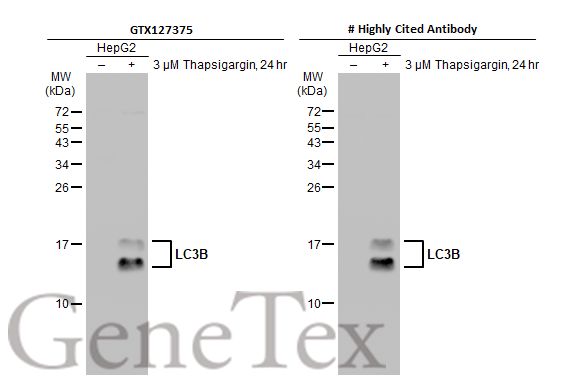 LC3B抗体 (GTX127375) | GeneTex中国官方网站