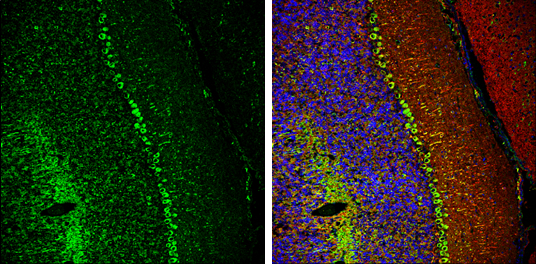 CaMKII alpha抗体 (GTX127939) | GeneTex中国官方网站